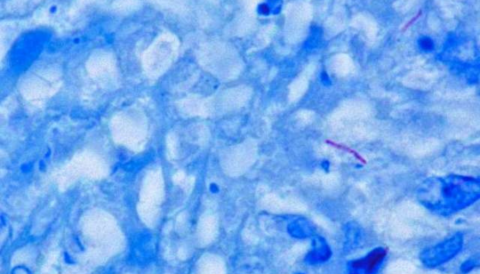 Bug Library - ACIPC - Australasian College for Infection Prevention and ...